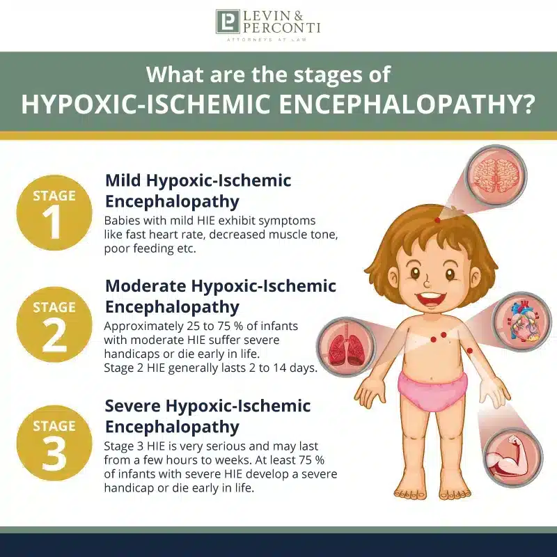 Stages of HIE: Mild, Moderate, and Severe HIE - Free Consultation